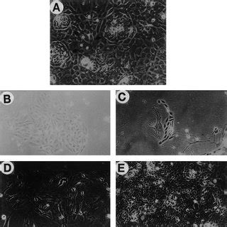 Image result for Cell Transformation