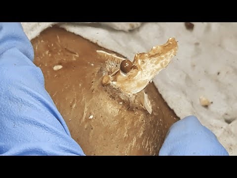 Dr. Lee’s Ultimate Deep Blackhead Extraction Most Satisfying Skincare Ever 2511SS 145238