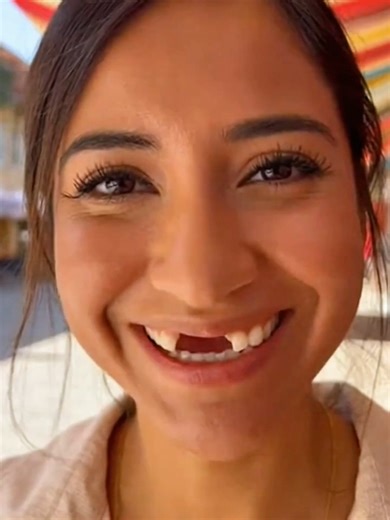 Simple Trick for Missing Teeth Replacement