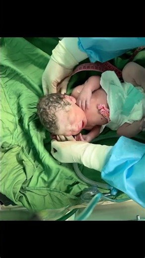 اندازه‌گیری قد و وزن نوزاد گریان 👶📏⚖️ | لحظه‌های واقعی تولد#newborncare#baby#مولود#قابلة#نینی#ماما