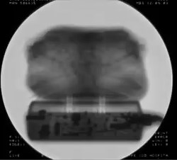 Oscar's radiology check: a radiologist visualised the internal functioning of Oscar's heart, lung and limb modules when linked. #projectoscar --> experience the full story here www.themodularbody.com | The Modular Body