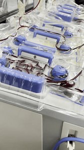 Platelet Plateletpheresis Procedure Separate Platelets Blood Stock Footage Video (100% Royalty-free) 3693410601 | Shutterstock