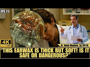 Dirty but Easy to Remove! Dr Adam Explains Safe Earwax Conditions
