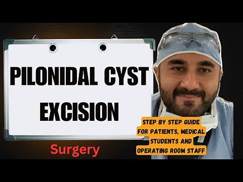 What to Expect for Pilonidal Cyst Excision Surgery 😳(Step by step guide) must 👀