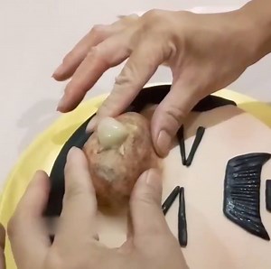 Pimple cakes are the latest trend and I have mixed feeling about them! 💥😨 | Onedio.co