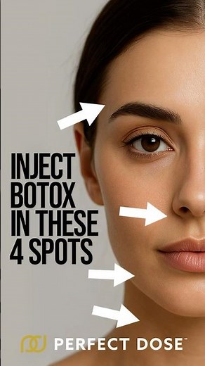 Inject Botox in THESE 4 Spots!