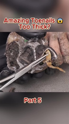 Amazing Toenails 😱 Too Thick Watch Them Trimmed Slowly 👣✨ Part 5 #satisfying #pedicure #toenailcare #oddlysatisfying #fyp