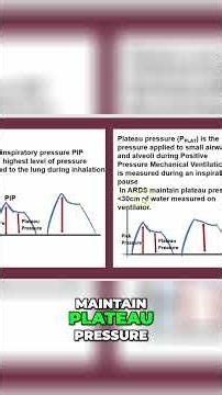 Medicine3Minute Mechanical Ventilation: PEEP, FiO2, Respiratory Rate, Tidal Volume #shorts