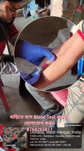 blood collection at your home #2 jangipur // Raghunathjang #healthtipsinbangla