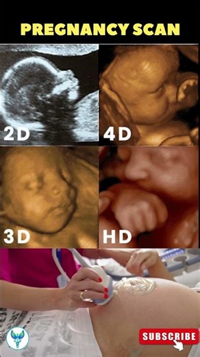 See your Baby face 😍 in pregnancy | 2D/ 3D/ 4D & HD baby Scan ✅ Pregnancy scan reports #shortsvideo