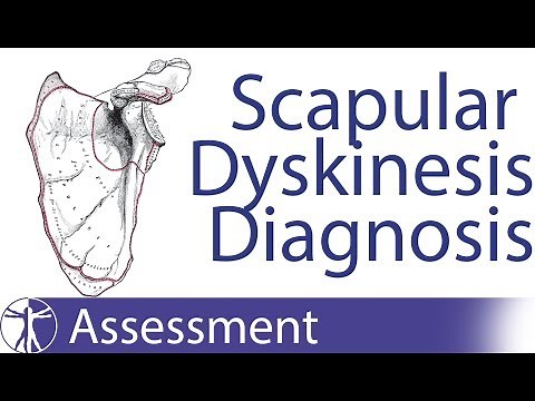 Diagnosing Scapula Dyskinesia