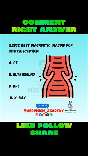 MedVision Academy on Instagram: "Comment Right Answer fast ⏩ . Like follow share @medvision_academy . Best diagnostic imaging for Intussusception is Ultrasound — it’s fast, non-invasive and highly sensitive for identifying the “target sign” or “doughnut sign” in children 🧒🩺 #MedicalStudents #NursingEducation #Pediatrics #NEETPG #MedVisionAcademy"