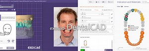 دانلود نرم افزار اگزوکد - DentalAppIran