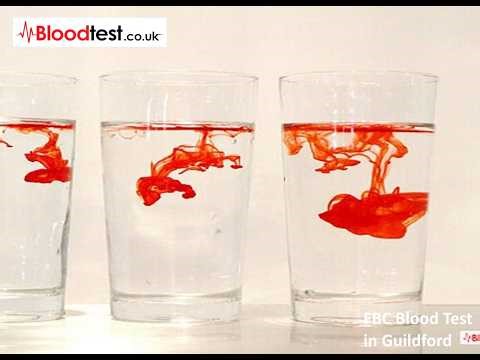FBC Blood Test in Guildford