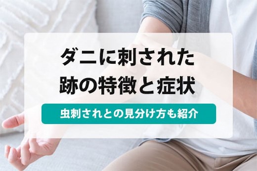 ダニに刺された跡【写真画像あり】症状の特徴や見分け方、跡をきれいに治す方法を紹介｜すまいのホットライン
