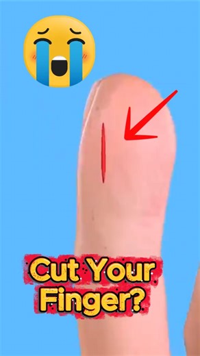 Why Paper Cuts Hurt So Much?😨#shorts