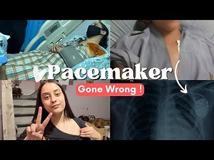 Pacemaker Emergency ! Full Update.