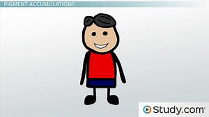 The Consequences of Intracellular Accumulations