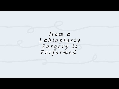 How a Labiaplasty Surgery is Performed