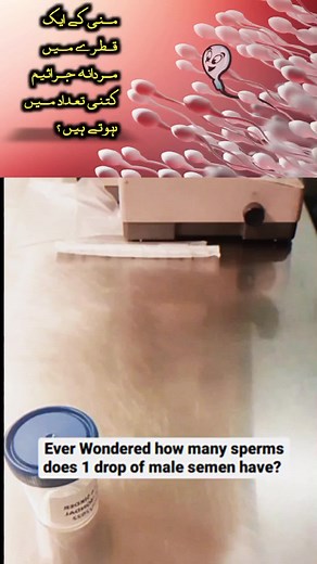 How Many Sperms Does One Drop of Male Semen Have?