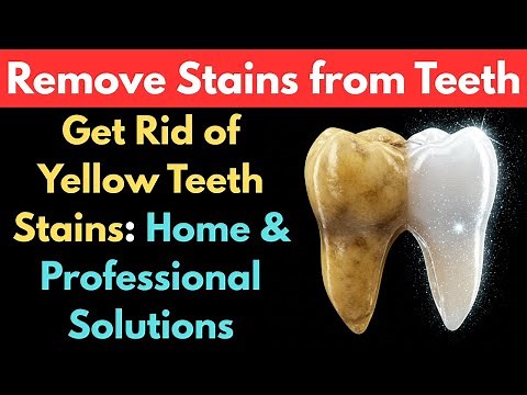 How To Remove Stains From Teeth | How To Remove Calculus on Teeth | How To Remove Tar From Teeth