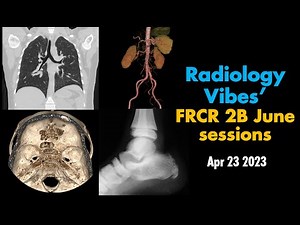 RadVibes FRCR 2B viva sessions - April 23 2023