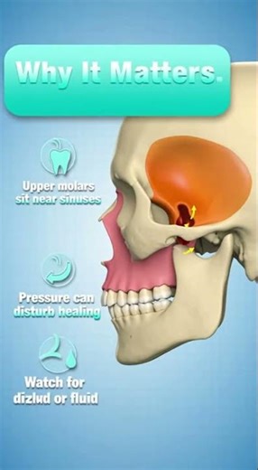 You’re not alone — this is a common worry after an upper tooth extraction.