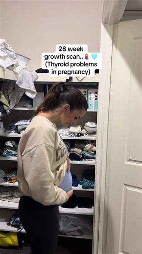 28 Weeks Pregnant Growth Scan Overview