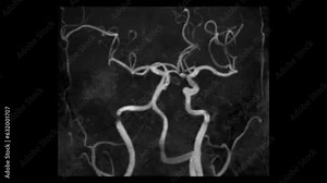 Human Skull 3d Scanning, CT and MRI Scanning