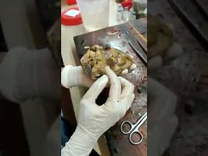 Heart dissection - Inflow outflow method | elearnerdeck