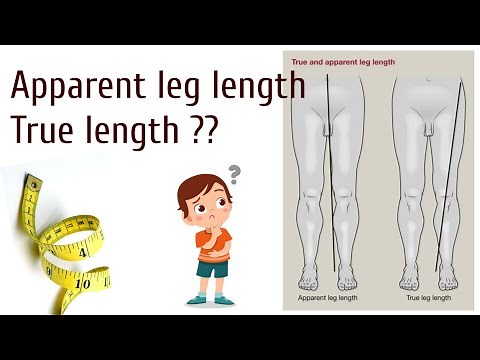 Apparent limb length and true length