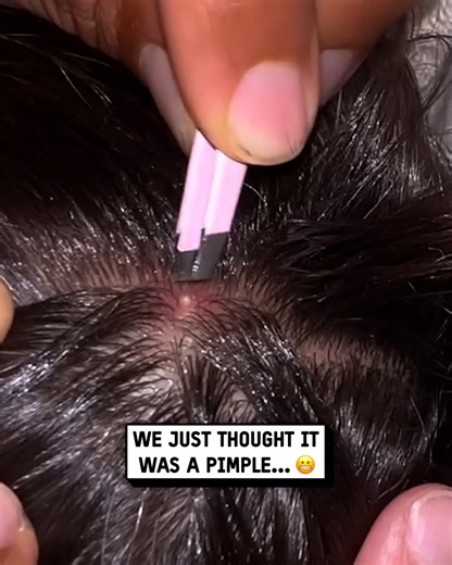 I can't believe I found this 😧 #insect #gross | UNILAD