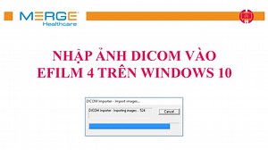 Phần mềm eFilm 4 trên Windows 10. Nhập ảnh DICOM từ CD/USB vào eFilm | Hình ảnh Y khoa | Chẩn đoán hình ảnh | Siêu âm, XQ, CT, MRI