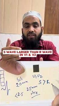 ECG interpretation | Normal value of P wave , QRS Complex and T wave| #ecg #cardiology #shortvideo