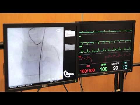 Cardiac Catheterisation Part 1 - Left Coronary