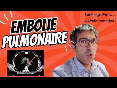 The exceptional diagnosis: Pulmonary Embolism on CT scan WITHOUT INJECTION