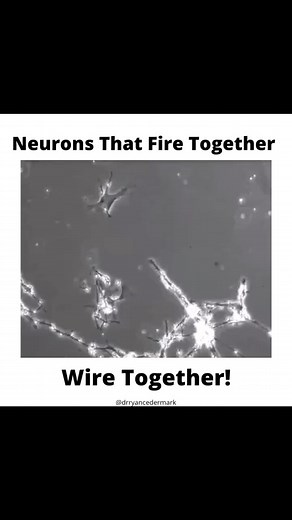 136 reactions · 80 shares | Neurons making new connections! | Dr. Ryan Cedermark | Facebook