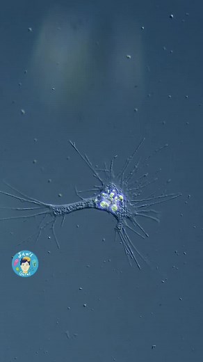 Amoebas are weird. Real-time footage. #shapeshifter #science