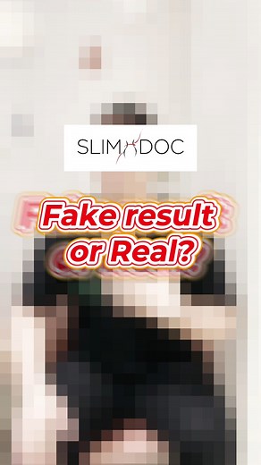 Wanna know the secret to our effective slimming results? It’s Atomic Blast! 💥 Using the latest technology from Korea, Atomic Blast helps you achieve a healthier & slimmer body in no time 😍 This treatment is completely painless and non-invasive, so you don’t have to worry about any pain! Ready for your glow up? PM us now 💌 | Slim Doc
