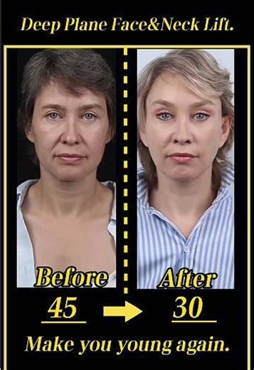 Transform Your Look with the 4D Composite Technique