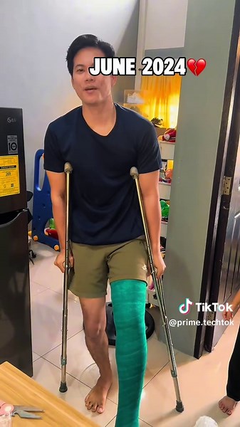 Bone Fracture Healing and Therapy Insights