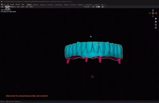 Bakr ibrahim on Instagram‎: "#dentaltechnology exocadofficial #dentalstudent # #dentaltechnican #dentallab #dentalassistant #dentalimplants# #dentalimplants #dentalcare #dentalhygiene #dentaldesign ##exocad_training #egypt #jordon #lebanon #iraq #طلبه_اسنان_الازهر #morroco #makkah #riyadh #jeddah #tunisia #albania #dental_student #unitedkingdom# #unitedstates #unitedarabemirates #united_dental_labor #tunisie #russia #unitedkingdom"‎