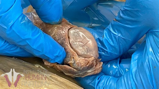 Male birth control explained: Vasectomies 101