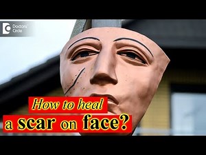 How do you heal a scar on your face? - Dr. Urmila Nischal