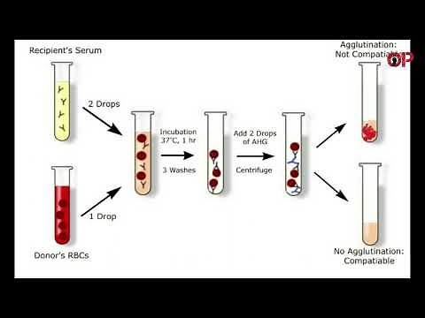 What is Cross matching? its Types , procedure and interpretation