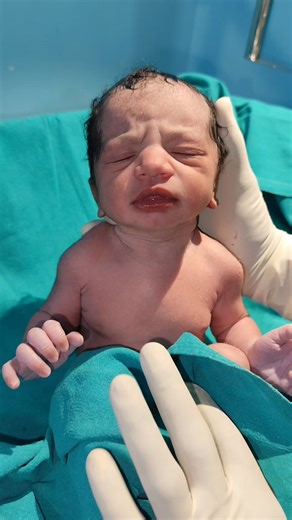 Initial Stimulation of a Newborn Baby | Critical First Moments After Birth and the First Cry#NewbornCare #FirstStimulation #CuteBabyMoments #BabyFirstTouch #AdorableBaby #NewLifeJourney #PreciousMoments #BabyLove #LittleMiracle #HeartTouchingMoments | Little Angel Care