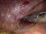 How do Dissect Duodenum • Video • MEDtube.net