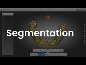 3. Segmentation - Manual & AI Segementation