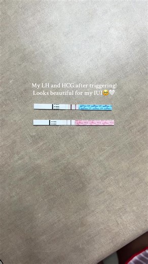 Understanding Trigger Shots in Infertility Treatments