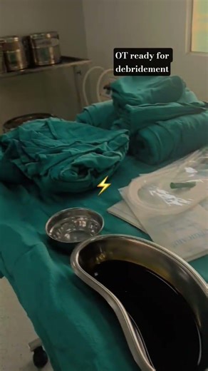 operation theater : live #livesurgery #hospital #OT #dreamdoctor #medicaldoctor